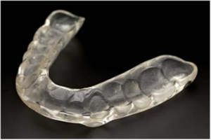 Splints - The TMJ Association